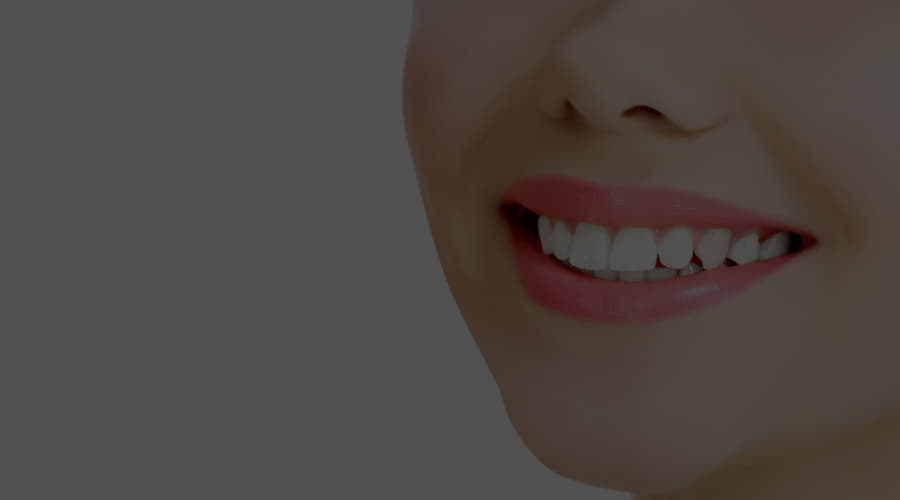 What is the Mock-Up in smile design? | Smile Care Cosmetic Centre