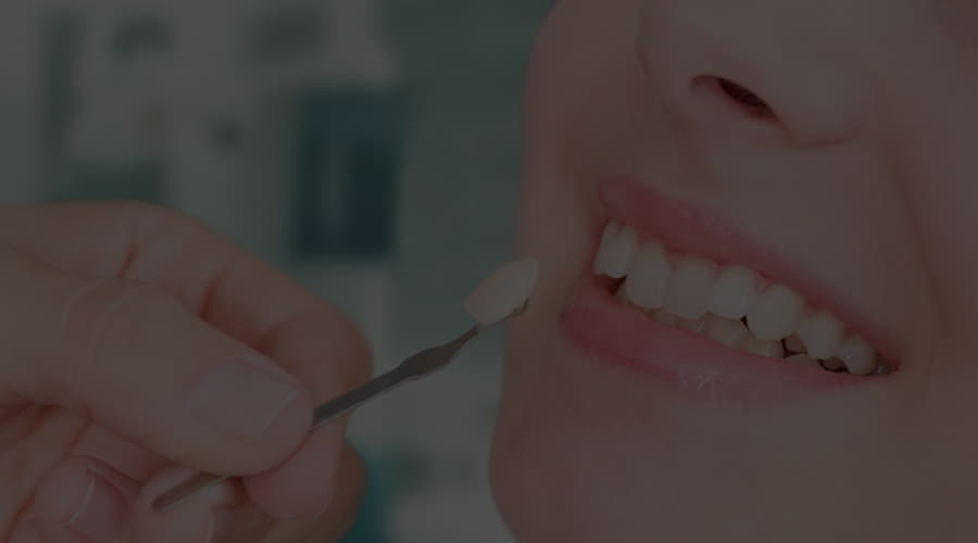 What is the minimum and maximum age to place a dental implant? - Smile Care