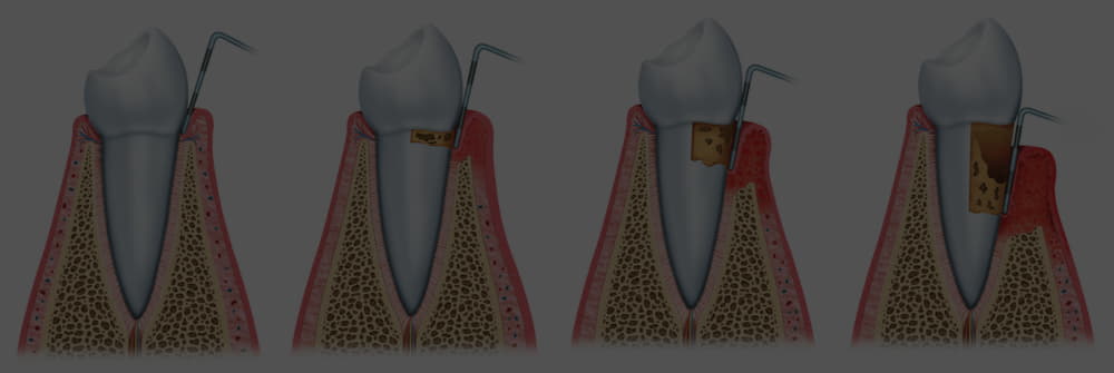 What is the periodontium and what are the parts that compose it ...